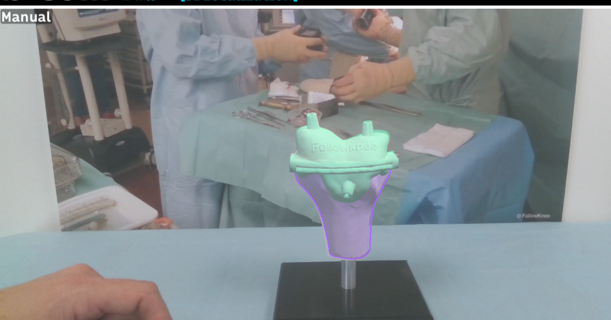 CARS: An AR application for orthopedic surgery | b-com
